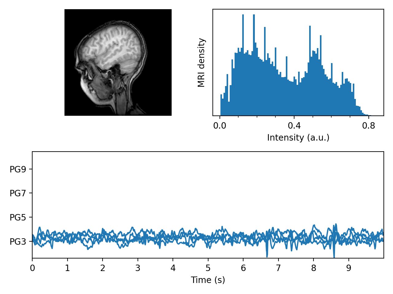 EEG를 이용한 MRI_Matplotlib - Python 시각화